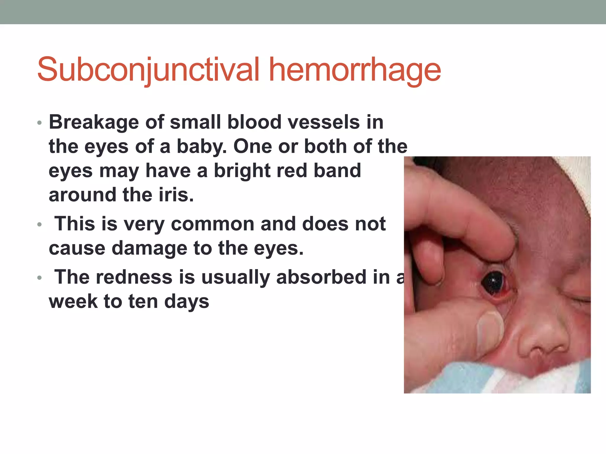 Management of common neonatal disorders | PPTX