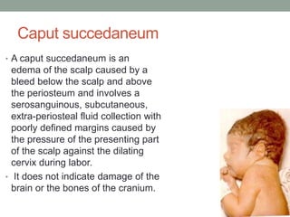 Management of common neonatal disorders | PPTX