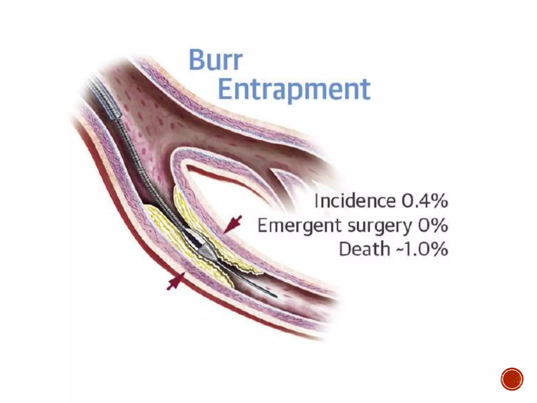 A Practical Approach to the Management of Complications During ...