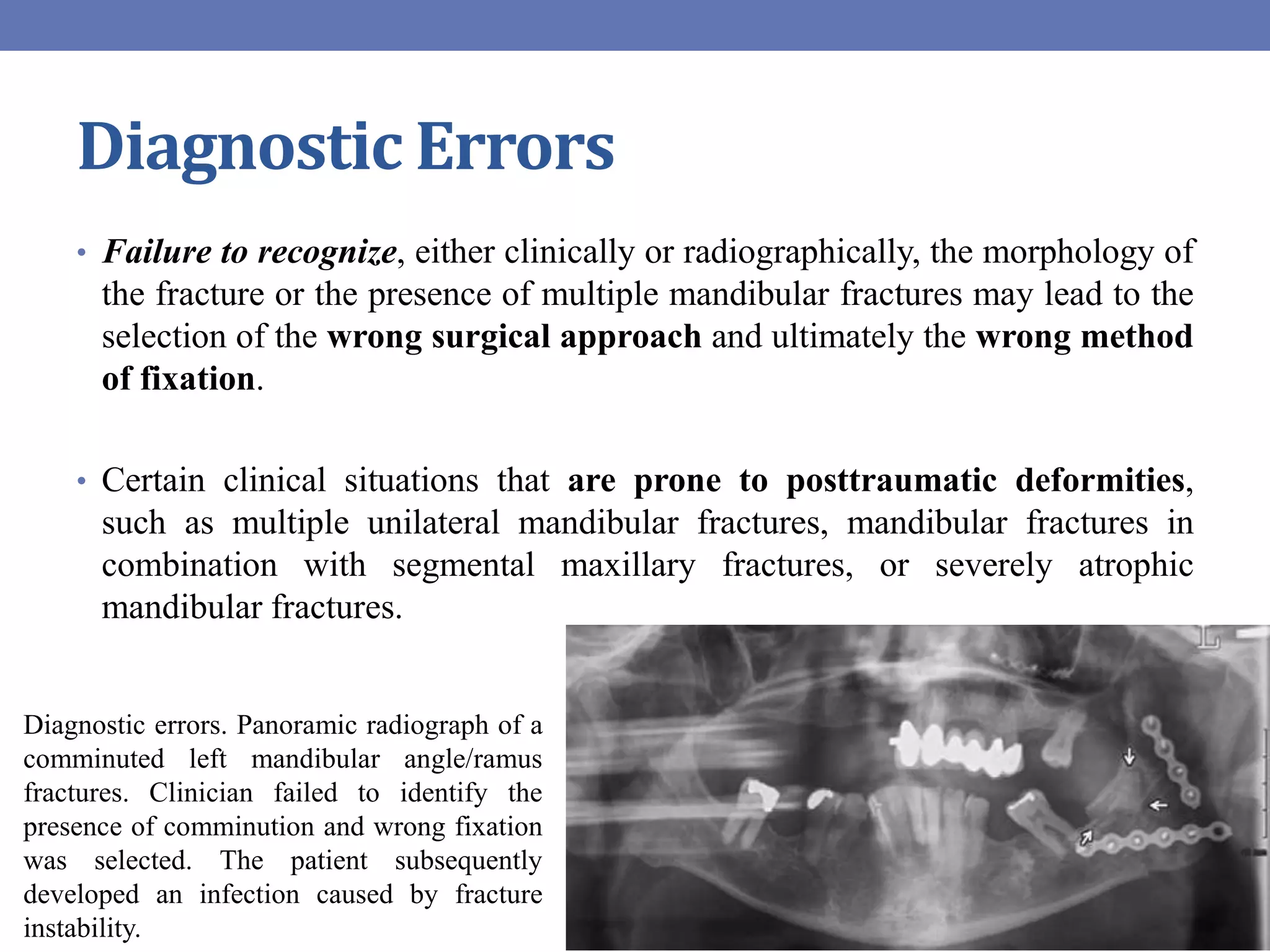 Management of complications of mandibular trauma | PPTX