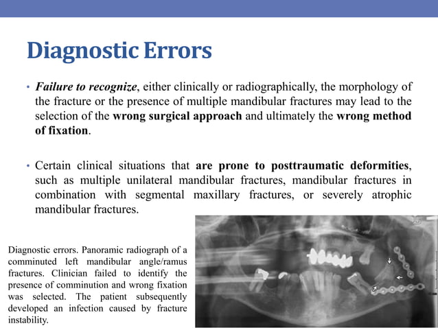 Management of complications of mandibular trauma | PPTX | Bone and ...