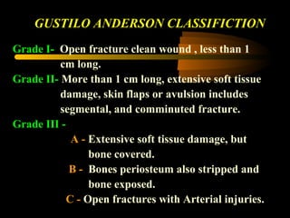 Management of compund fractures | PPT