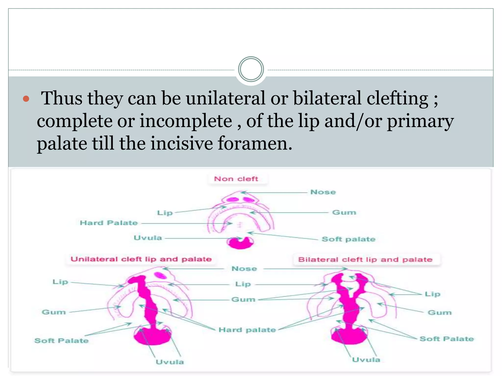 Management of craniofacial anomalies | PPTX