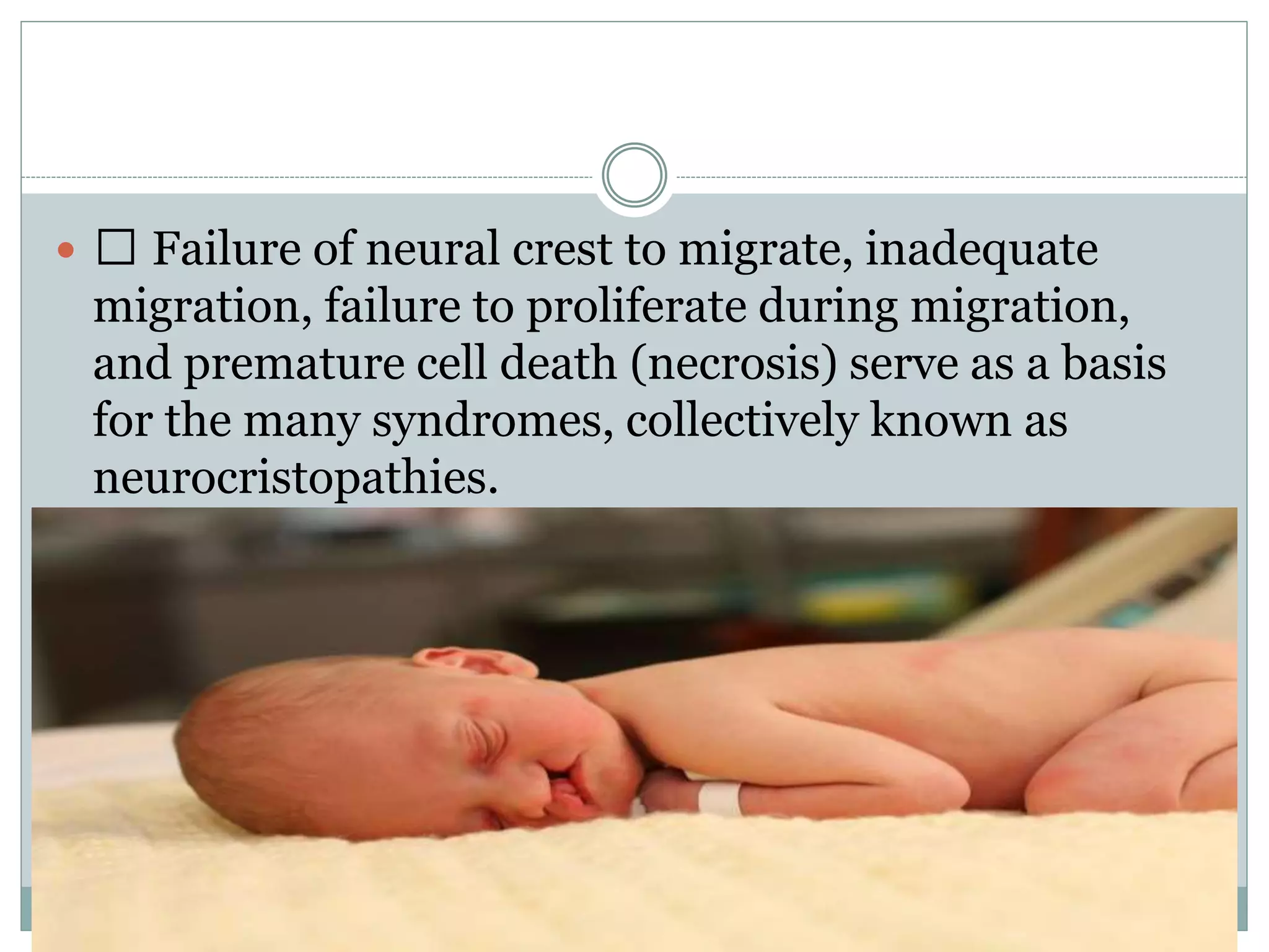 Management Of Craniofacial Anomalies Ppt