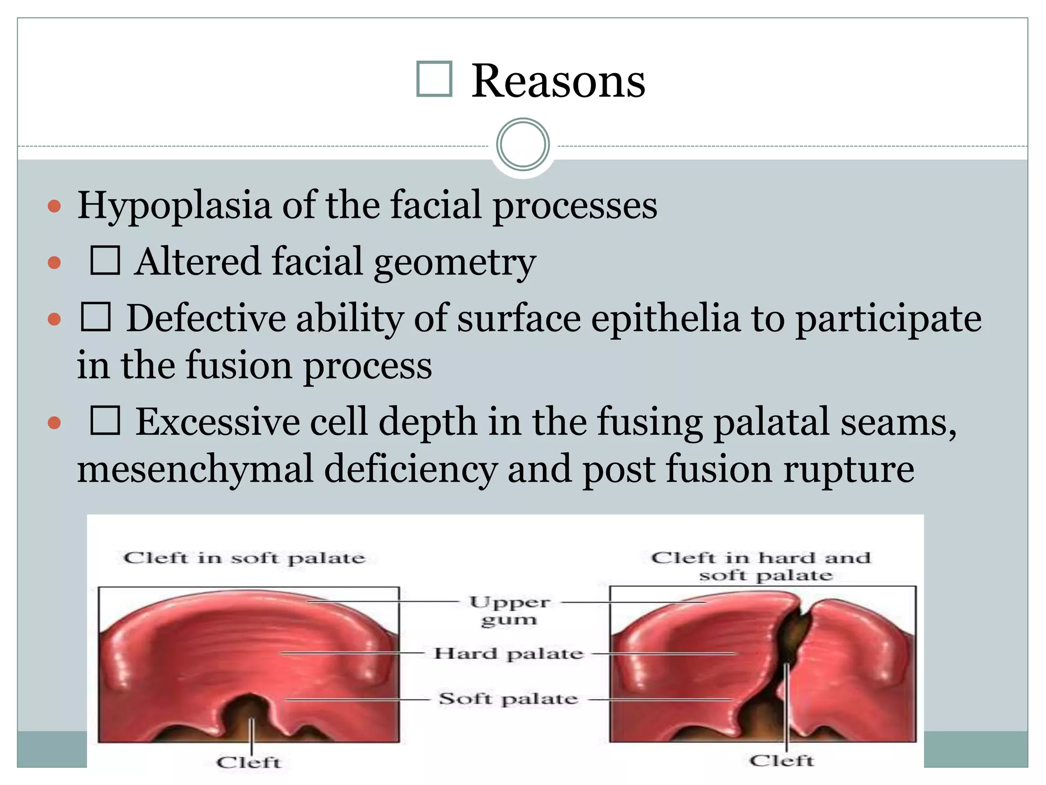 Management of craniofacial anomalies | PPTX