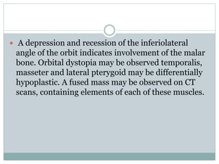 Management of craniofacial anomalies | PPTX
