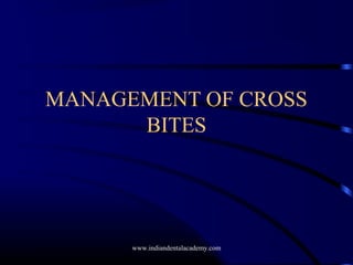 Management of cross bite | PPT
