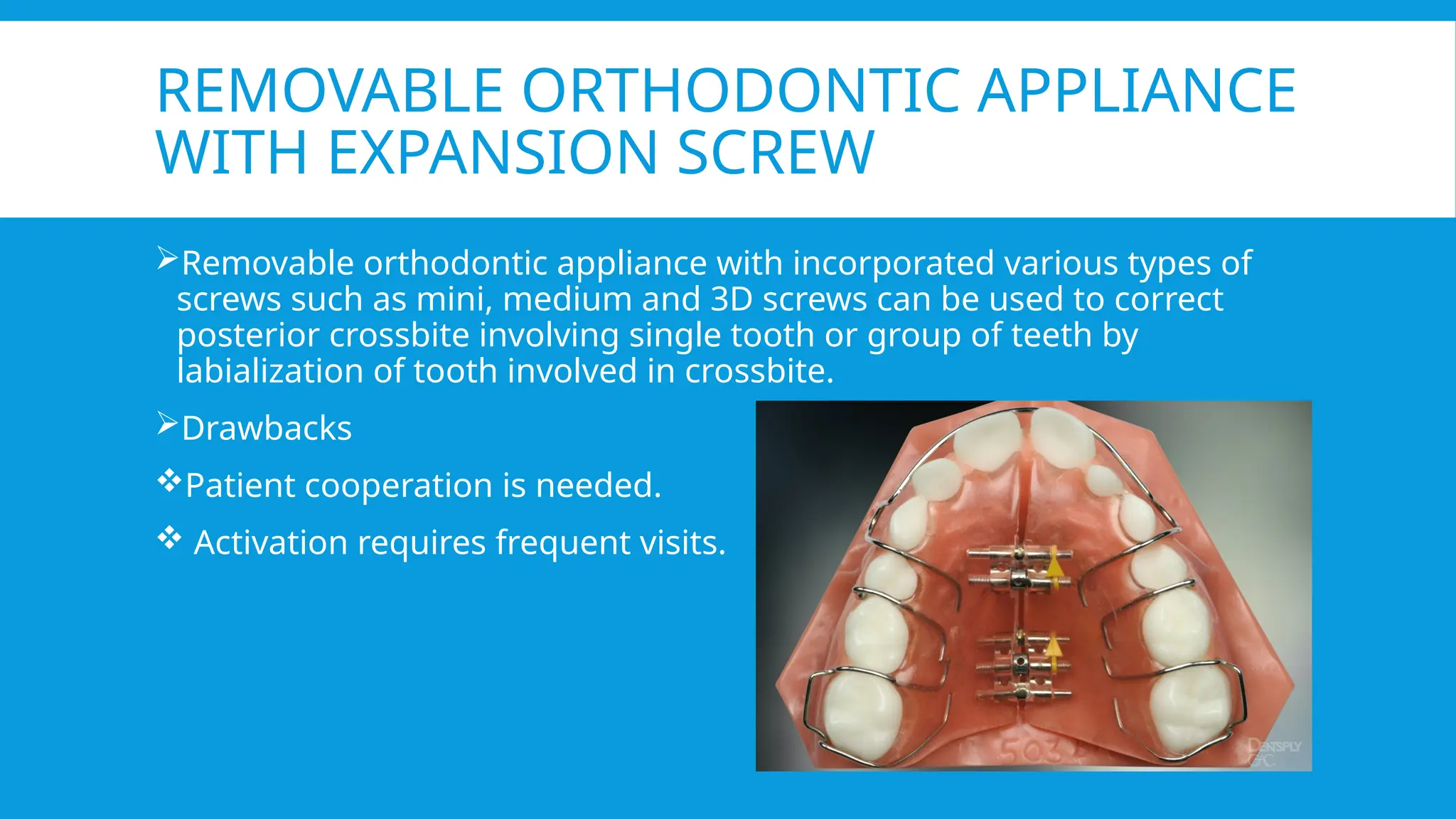 ORTHODONTIC Management of Crossbite.pptx