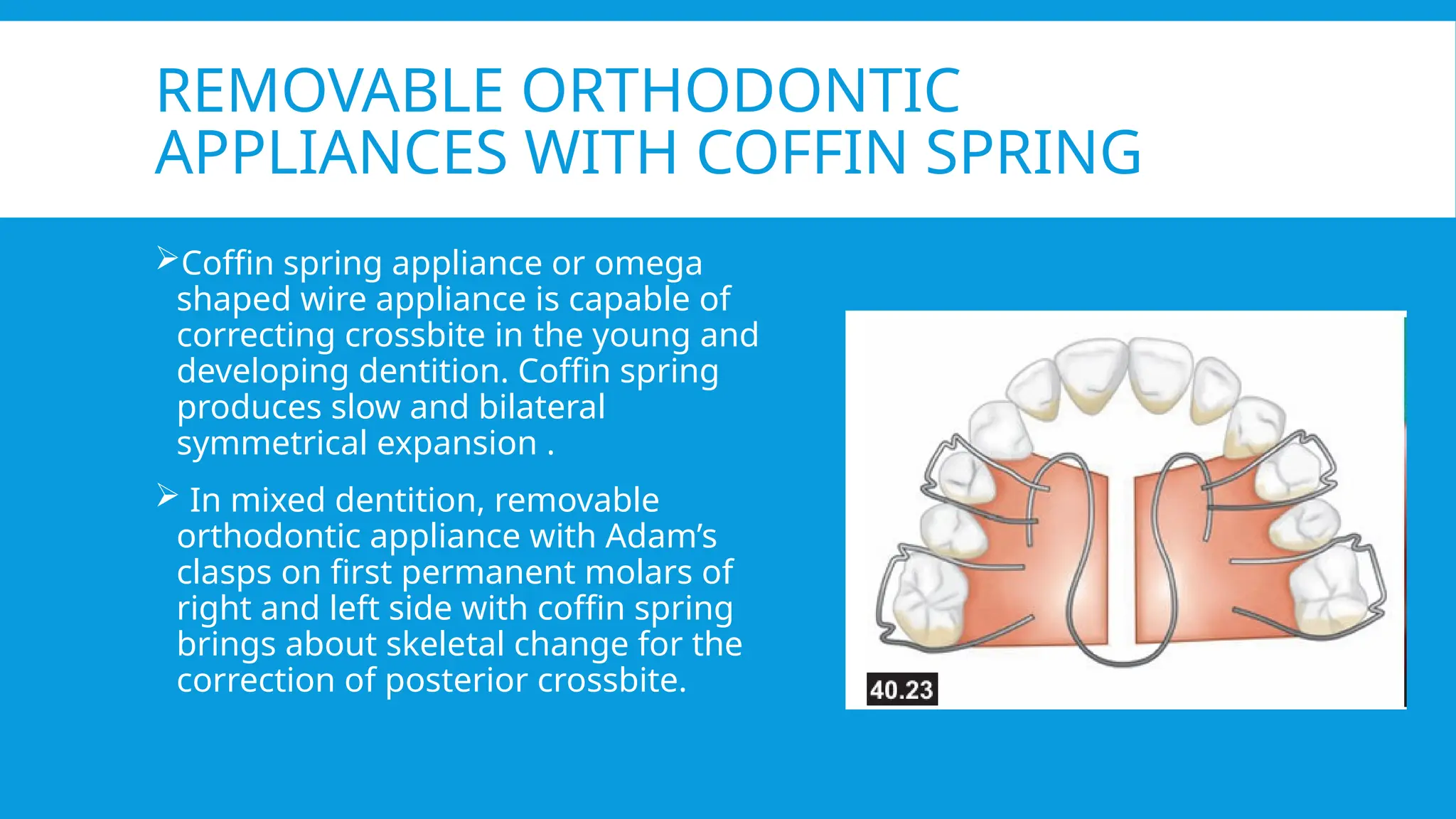ORTHODONTIC Management of Crossbite.pptx