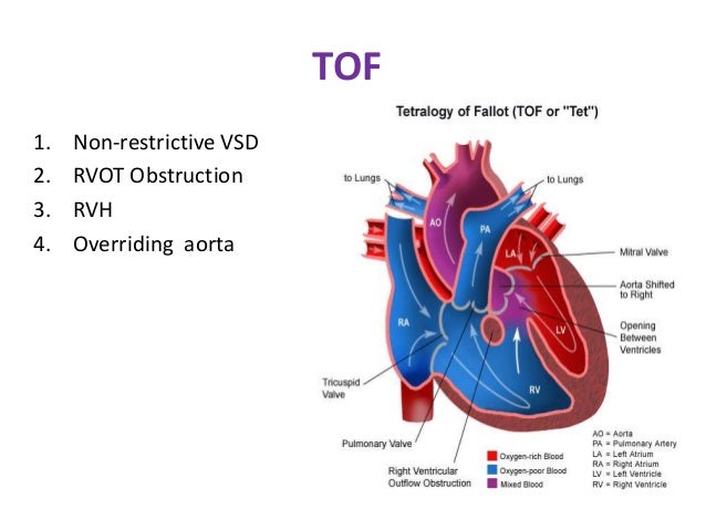 Management of cyanotic congenital heart diseae3