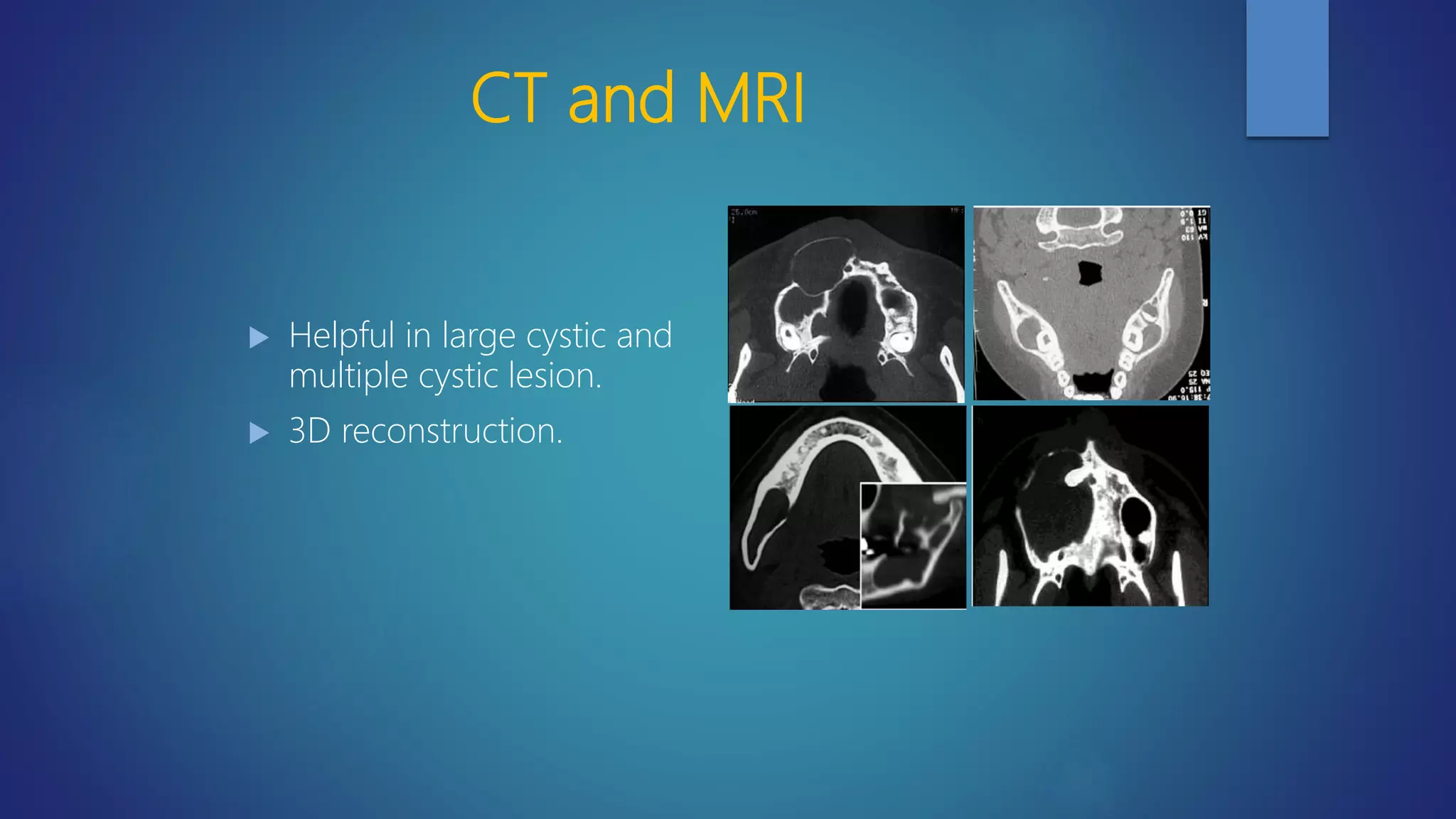 Management of cyst | PPTX