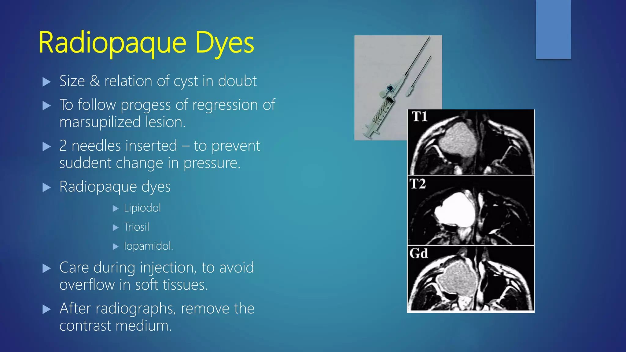 Management of cyst | PPTX