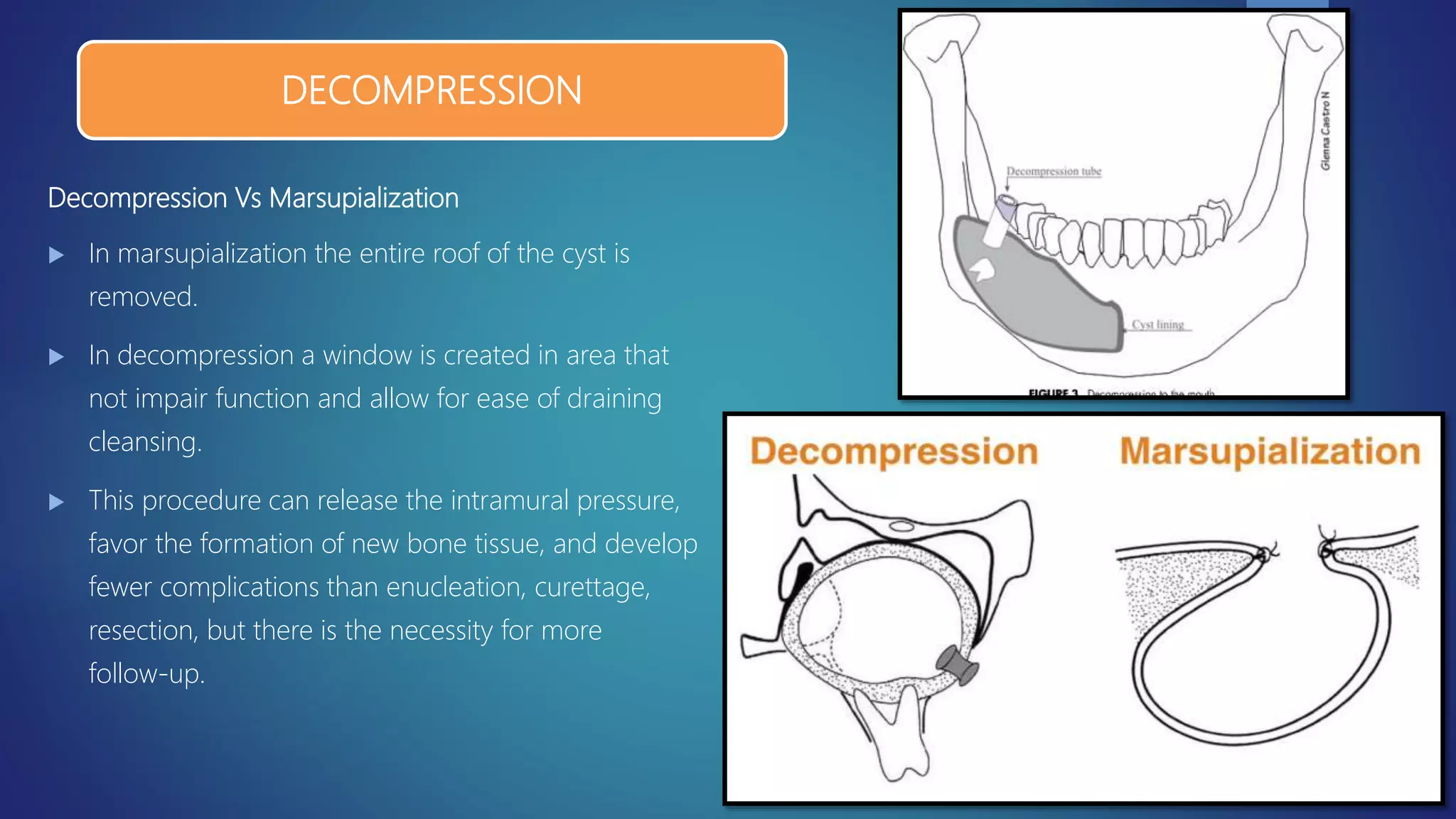 Management of cyst | PPTX