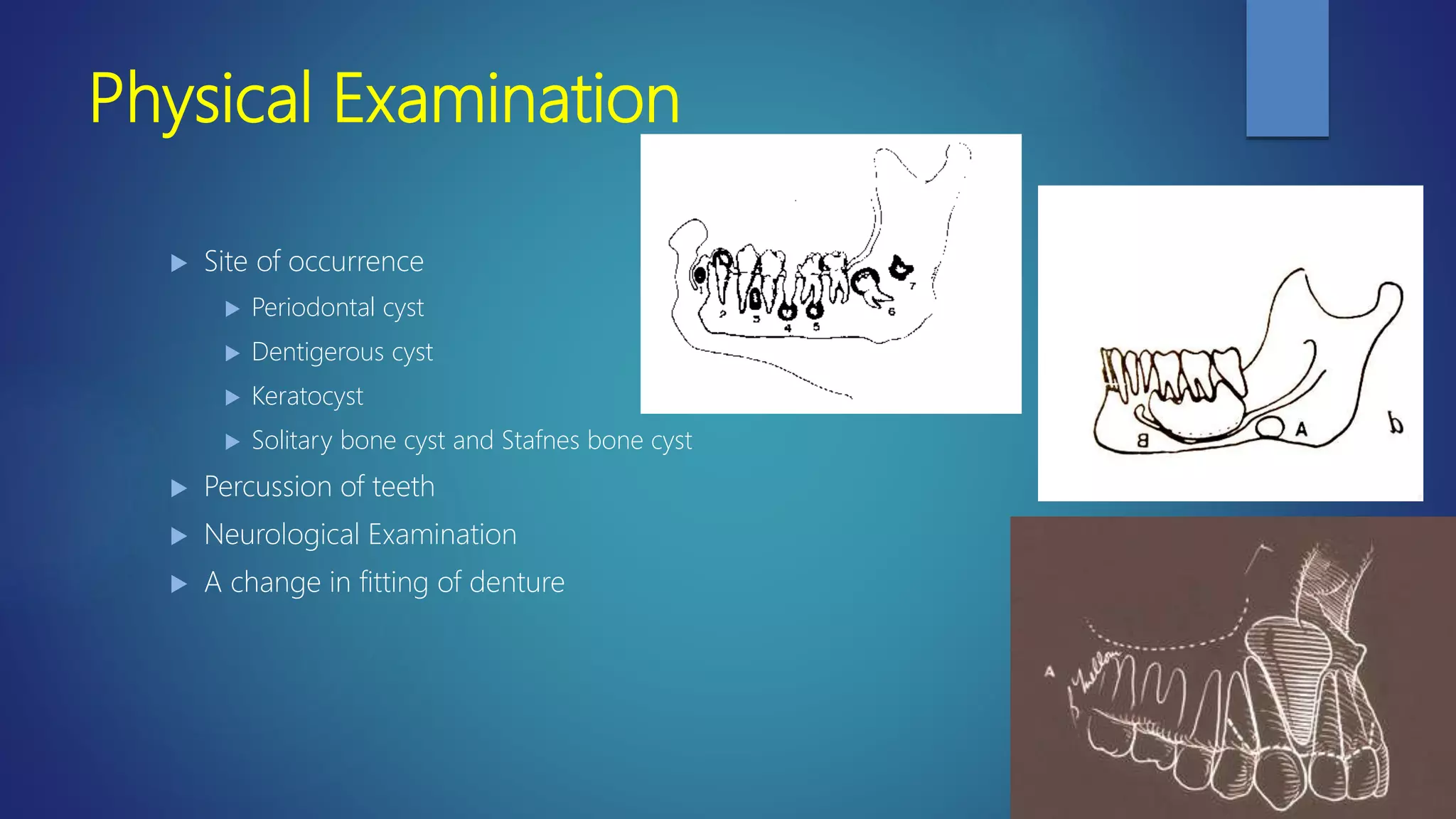 Management of cyst | PPTX