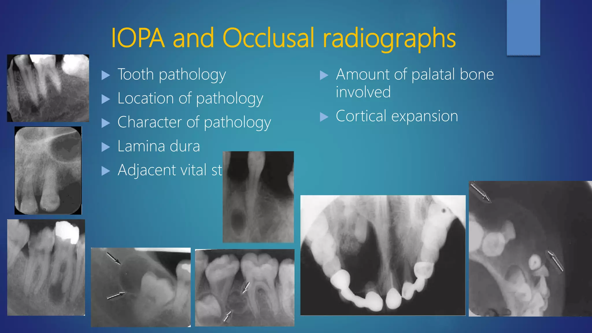 Management of cyst | PPTX