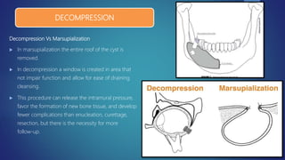 Management of cyst | PPTX