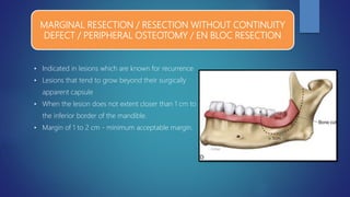 Management of cyst | PPTX