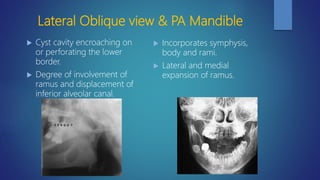 Management of cyst | PPTX