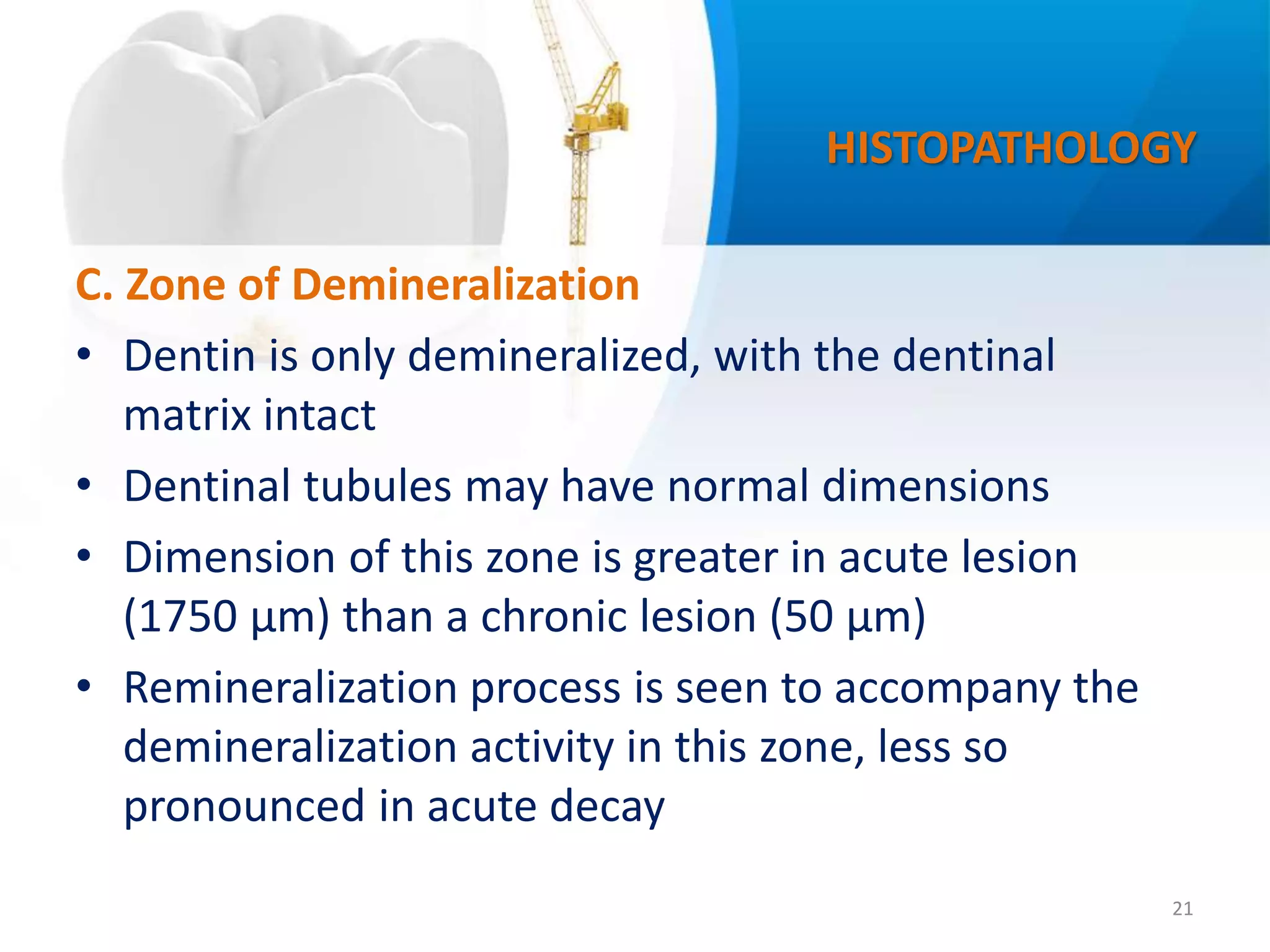 Management of deep carious lesions | PPTX