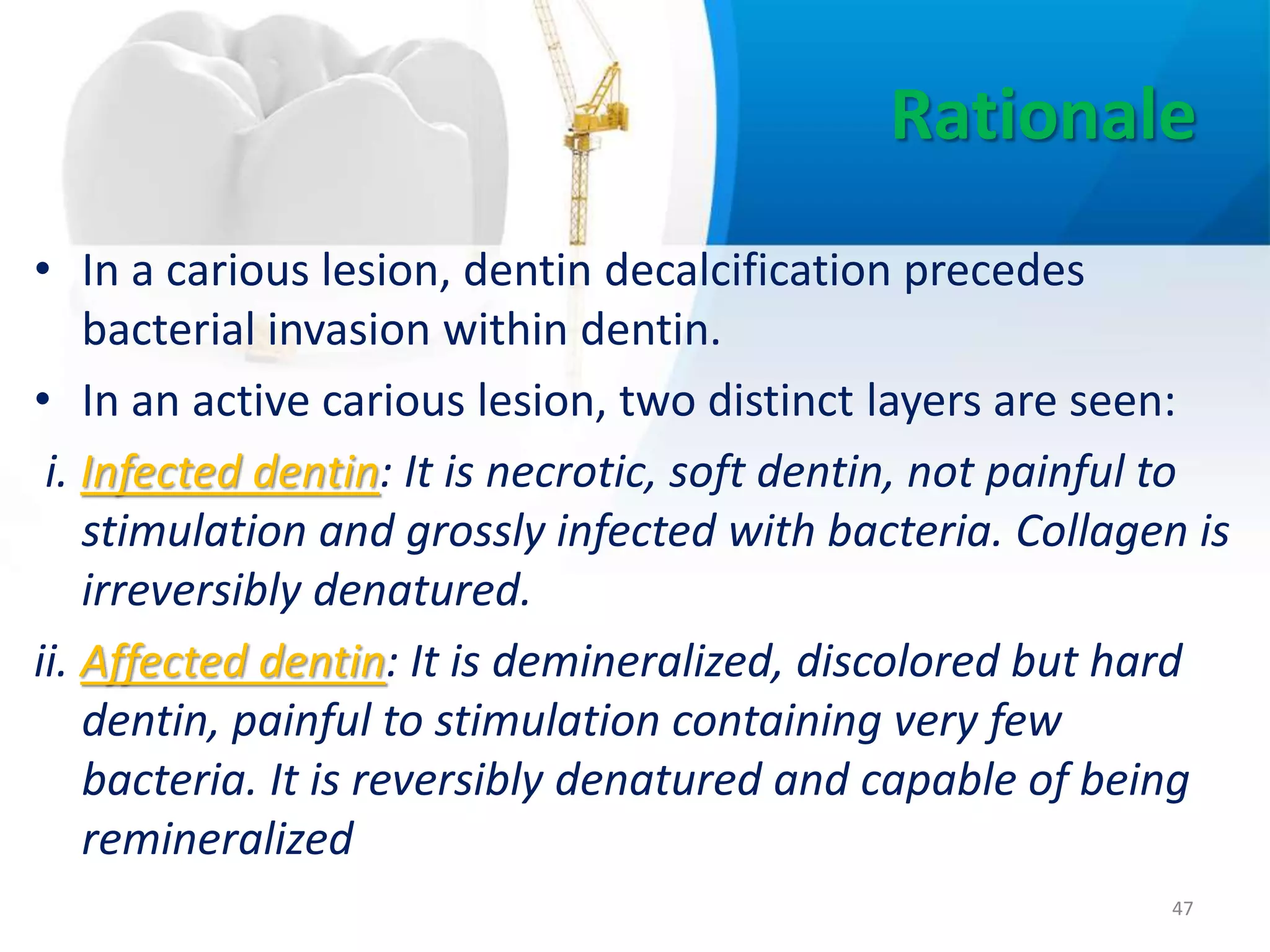 Management of deep carious lesions | PPTX