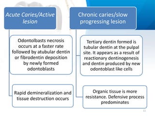 Management of deep carious lesions | PPTX