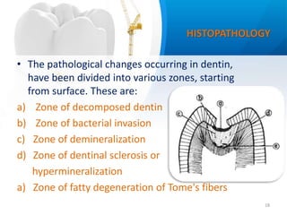 Management of deep carious lesions | PPTX