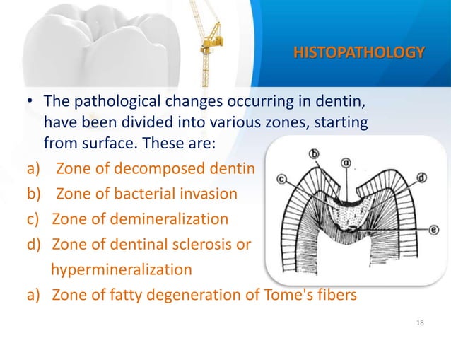 Management of deep carious lesions | PPTX | Dental Health | Diseases ...