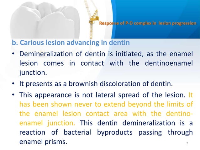 Management of deep carious lesions | PPTX | Dental Health | Diseases ...