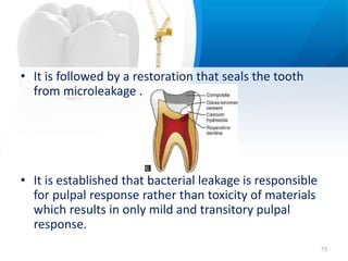 Management of deep carious lesions | PPTX