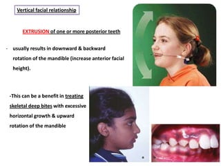 Management of Deep Bite _ Dr. Nabil Al-Zubair | PDF