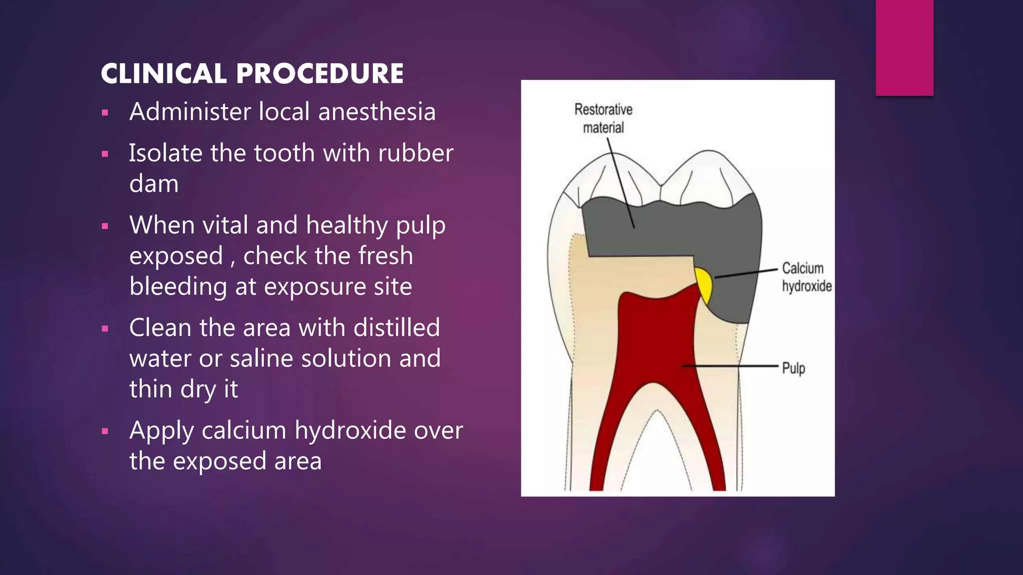 Management of deep carious | PPTX