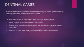 Management of deep carious | PPTX