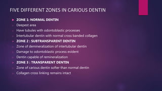 Management of deep carious | PPTX