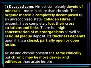 Management of Deep carious lesion (1).ppt