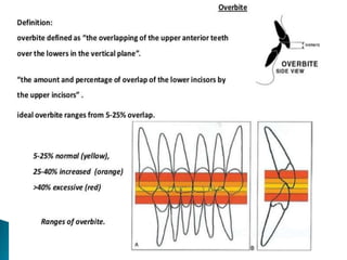 Management of deep overbite | PPTX