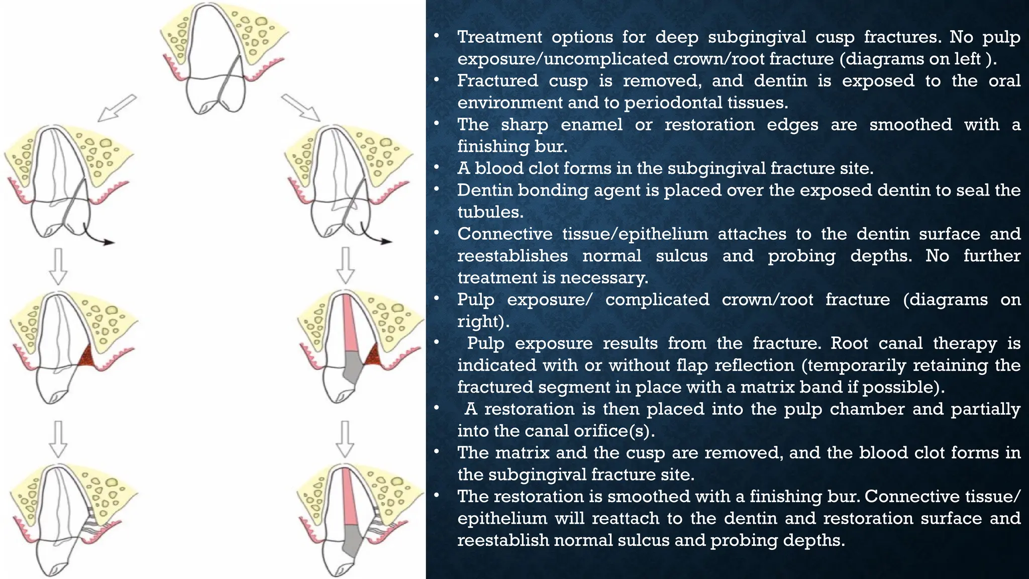 MANAGEMENT OF DEEP SUBGINGIVAL FRACTURES JC.pptx