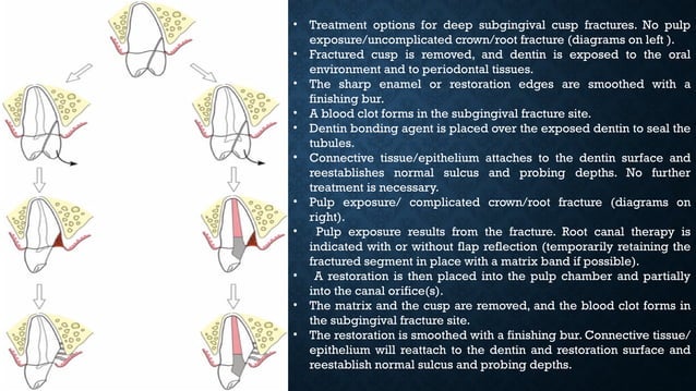 MANAGEMENT OF DEEP SUBGINGIVAL FRACTURES JC.pptx