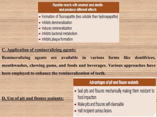 Management of dental caries | PDF | Oral care | Personal Care