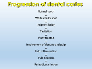 Dental Caries Treatment Ppt