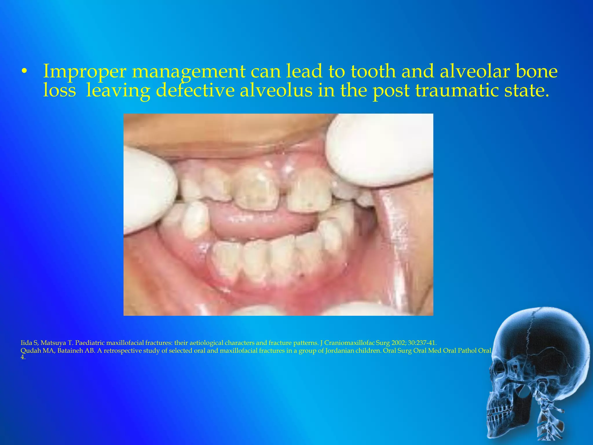 Management of dento alveolar trauma | PDF
