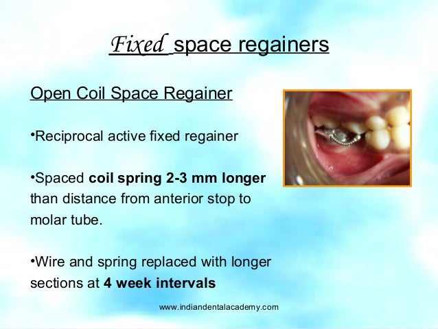 Management of developing occlusion