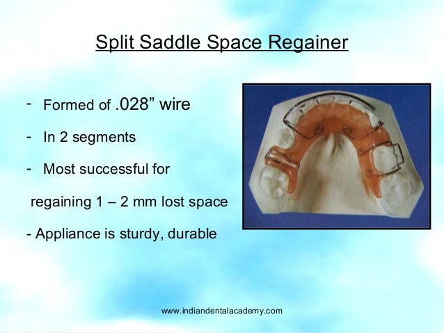 Management of developing occlusion