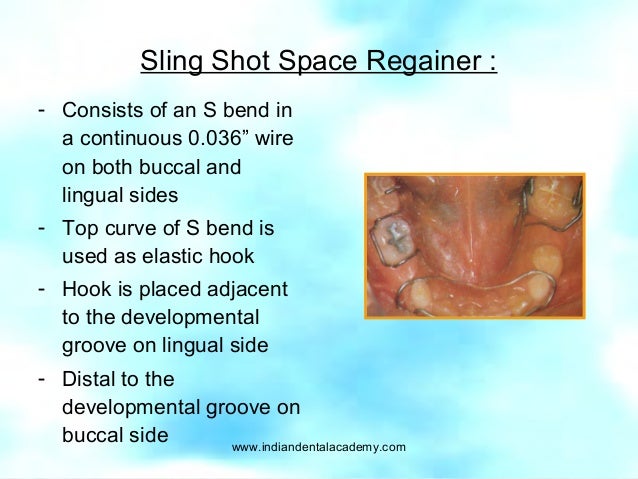 Management of developing occlusion