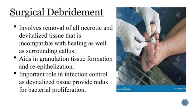 Management Of Diabetic Foot Ulcers .pptx
