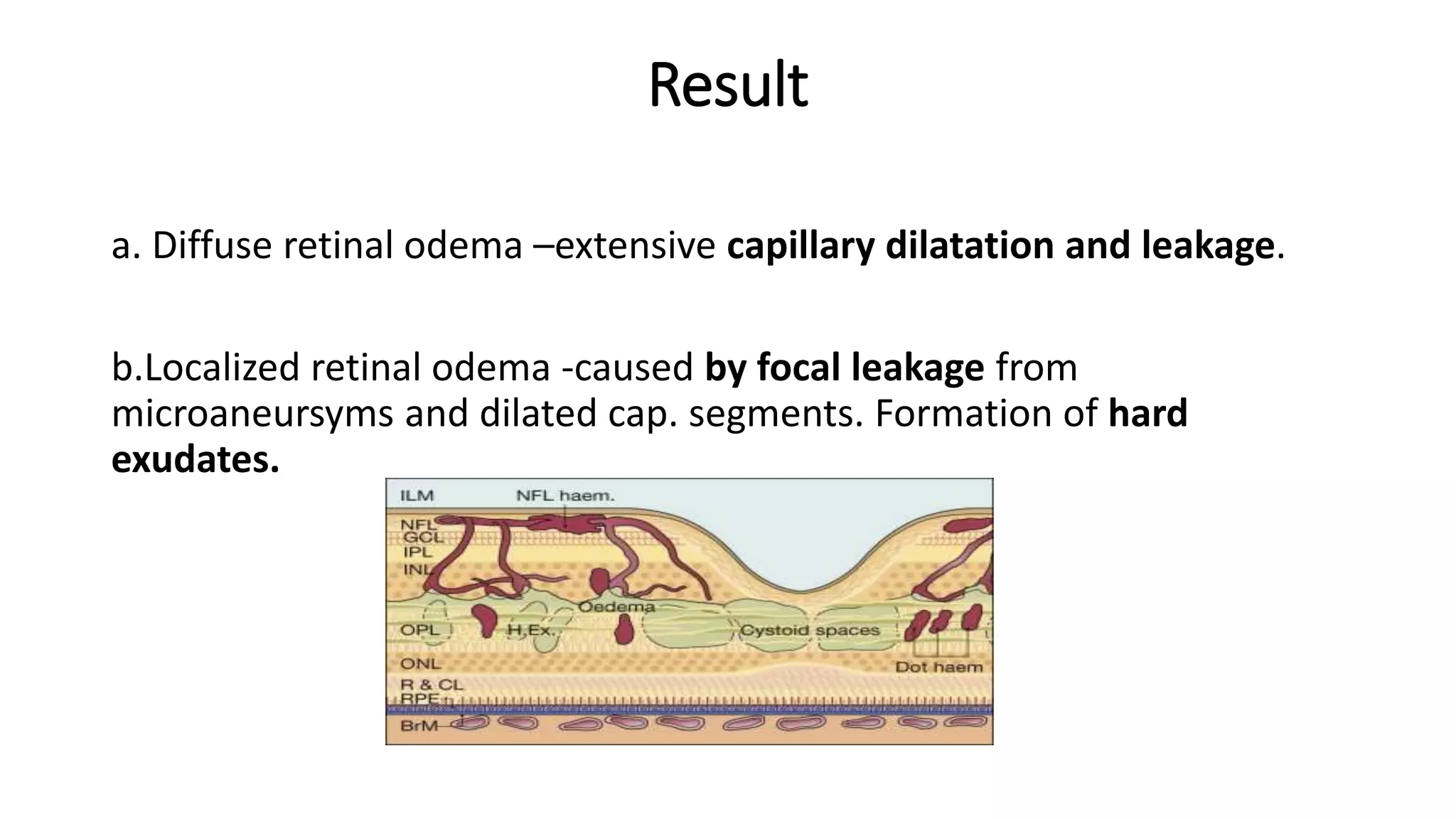 Management of diabetic retinopathy | PPTX