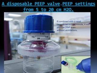 Management of Difficult Airway | PDF | Lung and Respiratory Health ...