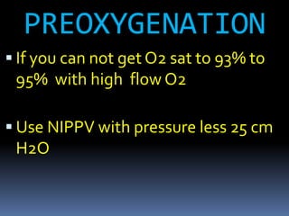 Management of Difficult Airway | PDF | Lung and Respiratory Health ...