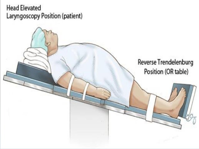 Management of Difficult Airway