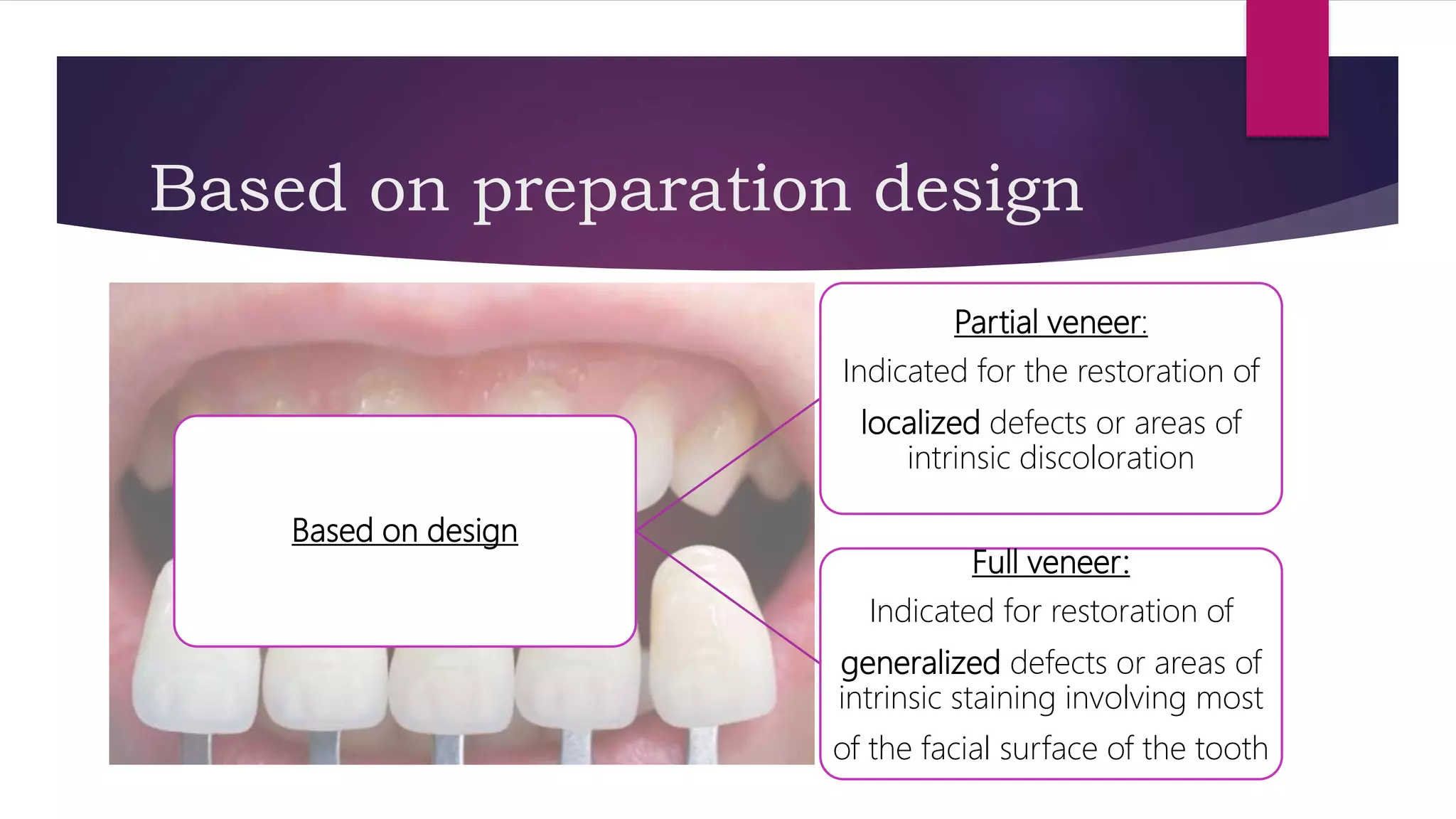 MANAGEMENT OF DISCOLORED TOOTH.pptx