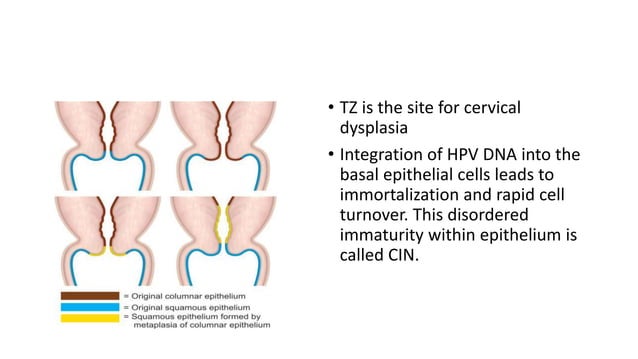 Management of diseases of cervix